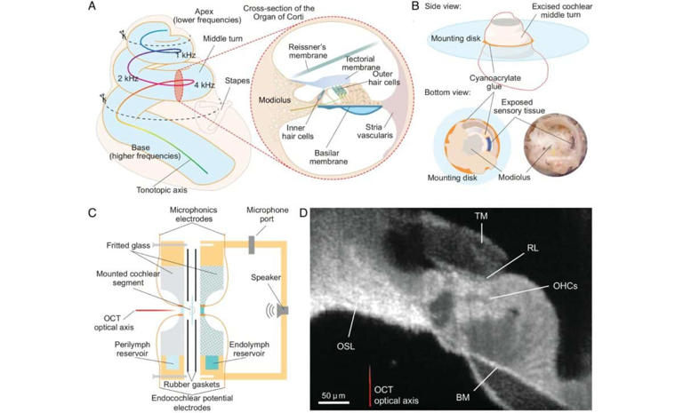 The future of hearing loss treatment starts with this ear breakthrough