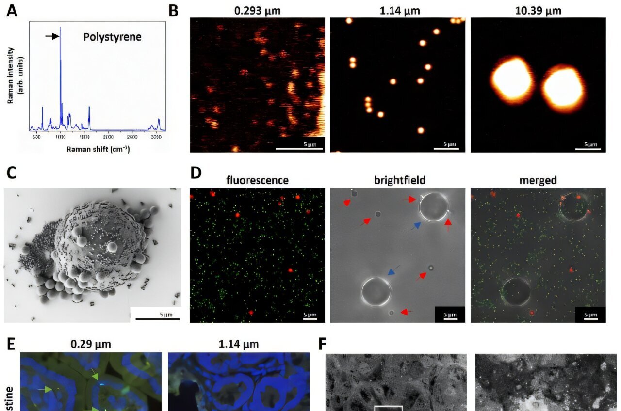 Plastic particles can increase intestinal inflammation
