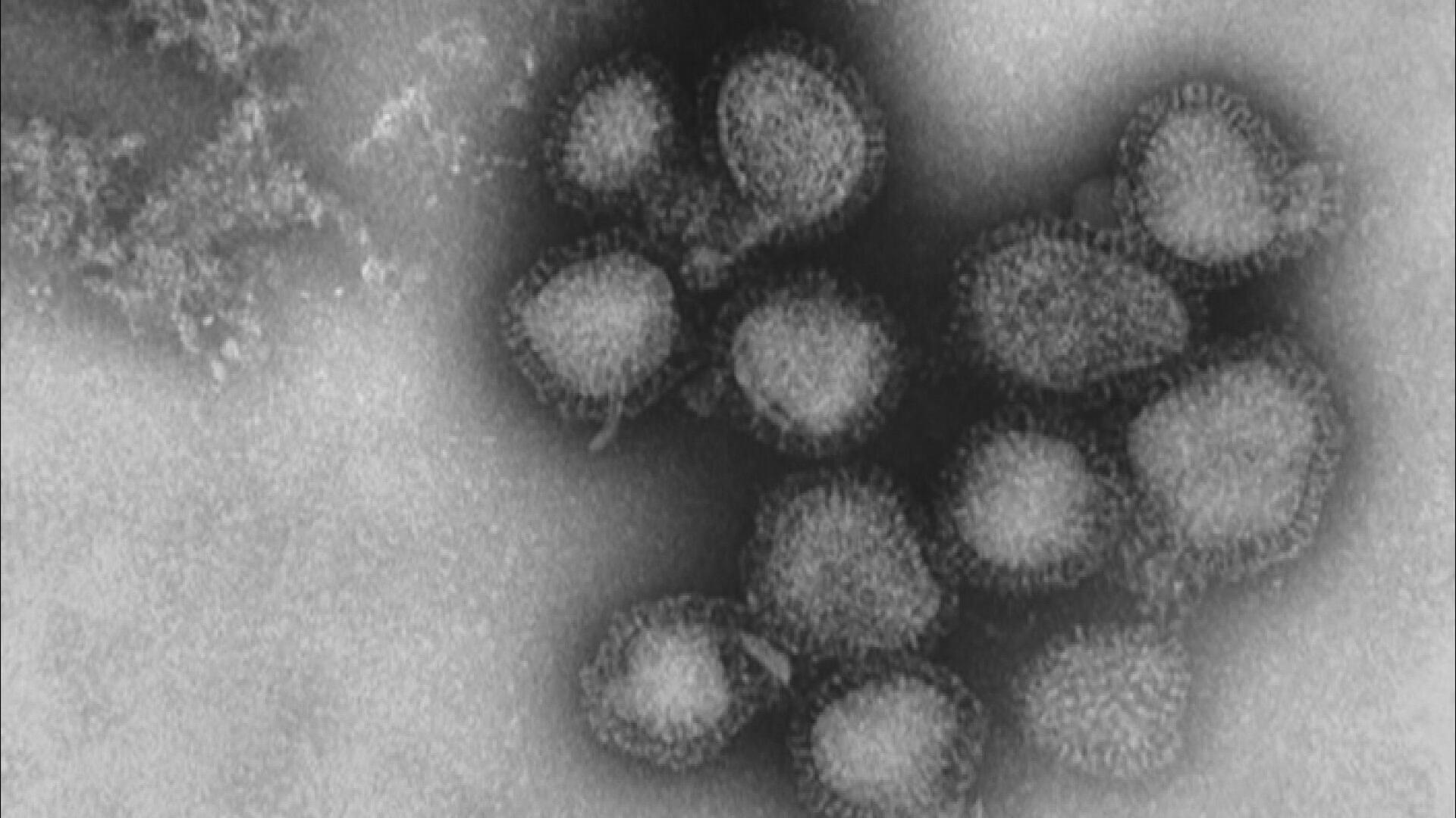 Nearly 5,000 people have died from the flu so far this season, CDC says