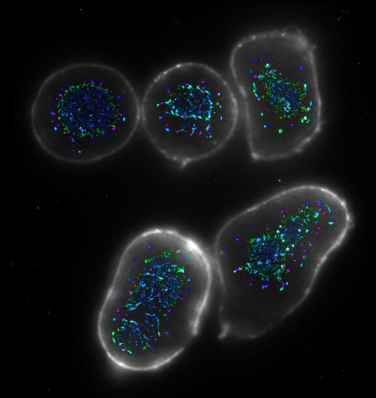 Multi-pronged antibodies could boost immune response to cancer