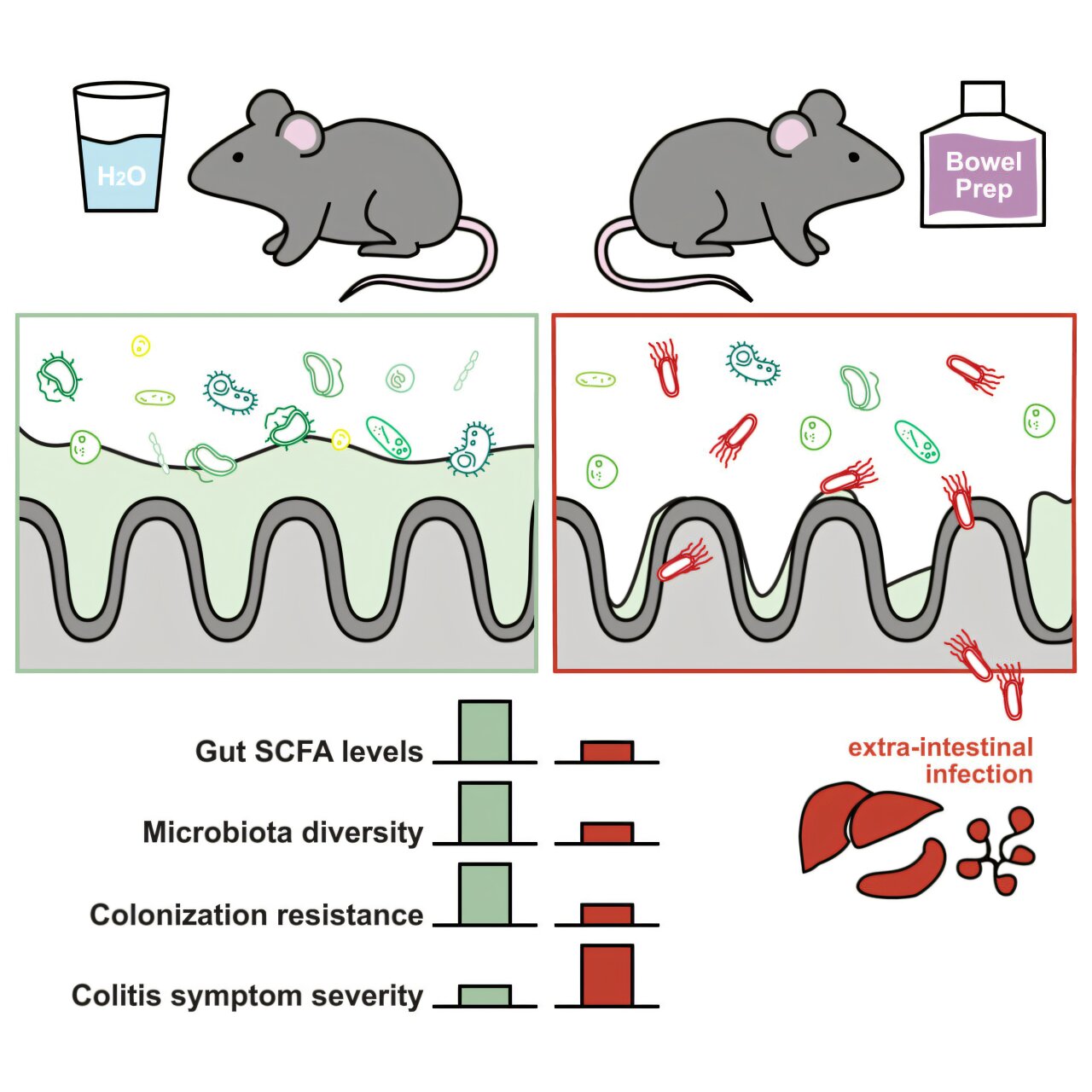 Colonoscopy bowel prep temporarily weakens gut defenses against ...