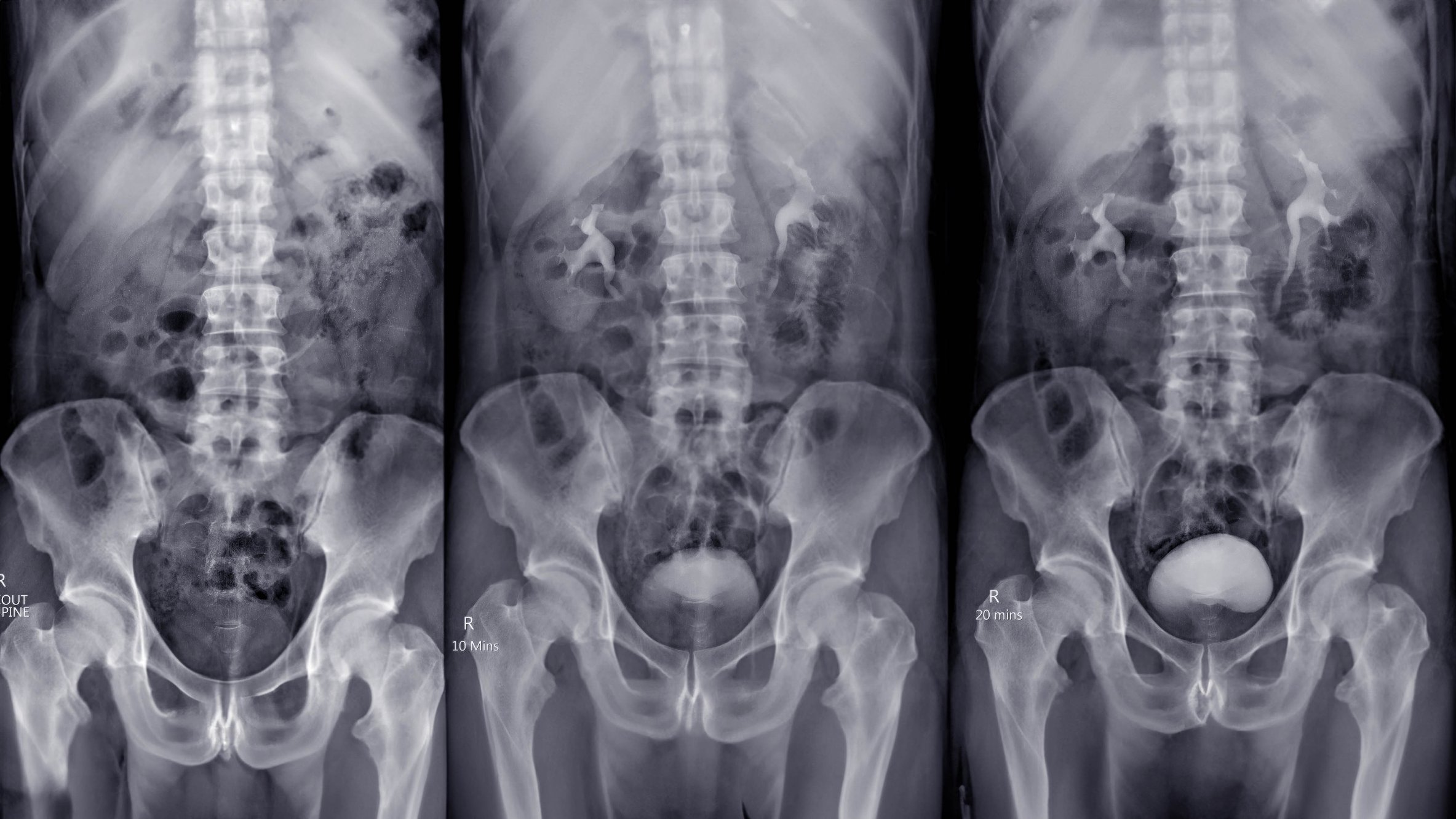 Knytter «skjult» virus til kreft