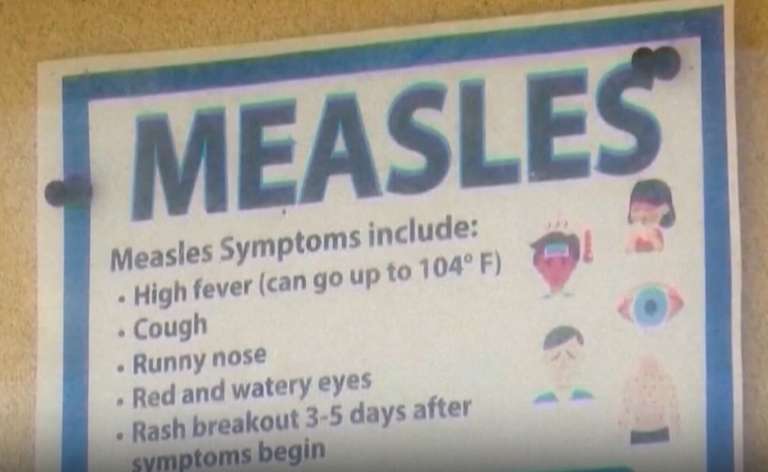 Recent measles exposure in Northern Kentucky followed by outbreak in Ohio