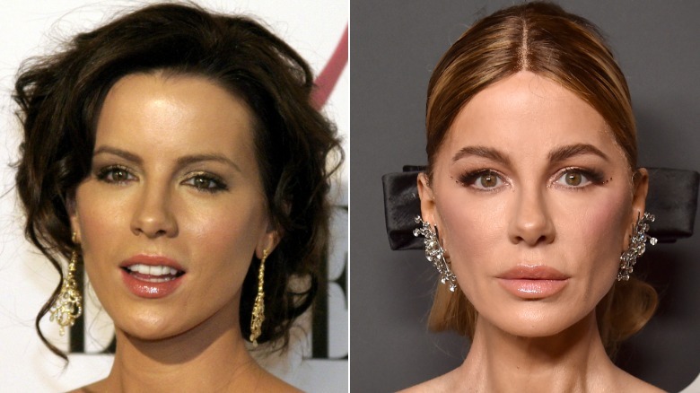 Kate Beckinsale's rumored plastic surgery has transformed her face