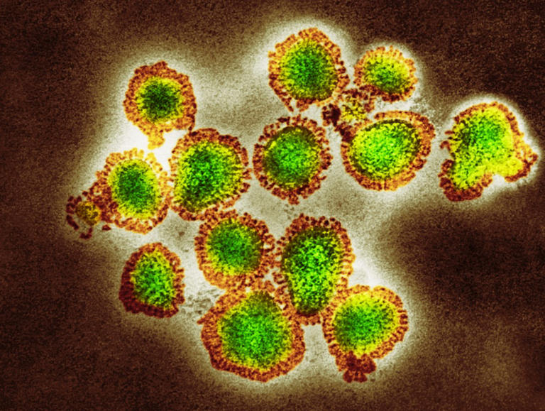 These are the most common H3N2 super flu symptoms doctors are seeing ...