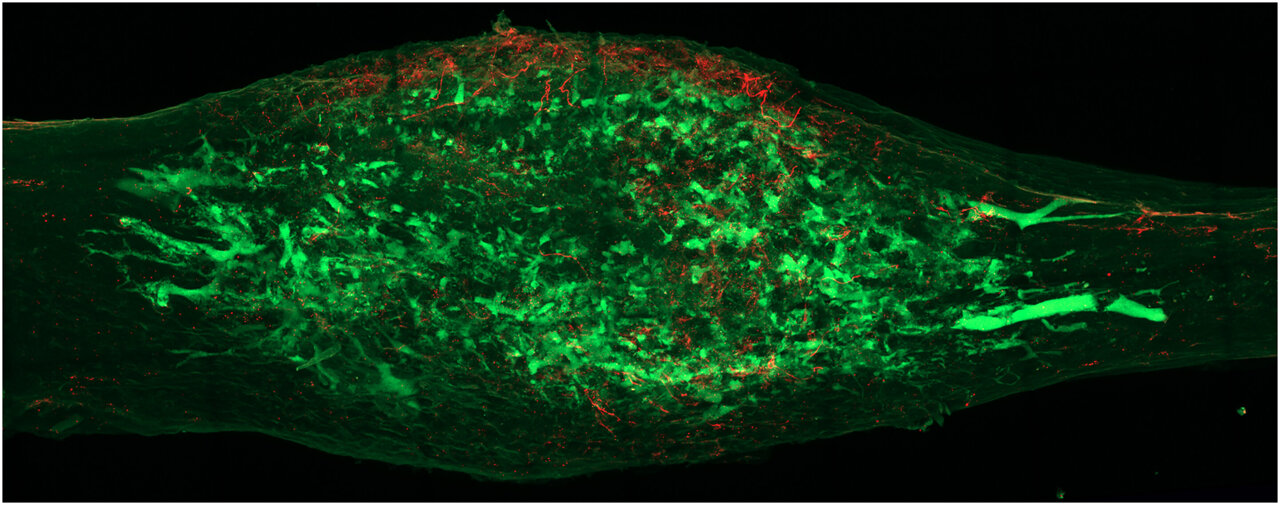 First map of nerve circuitry in bone helps physicians identify key ...