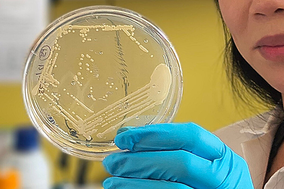 Rare condition that causes body to produce its own alcohol demystified