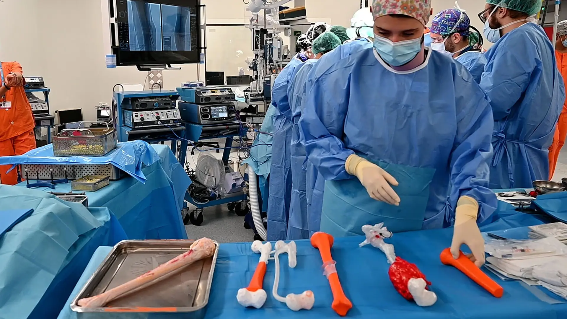 El Gregorio Marañón evita amputar la pierna de un niño con cáncer al ...