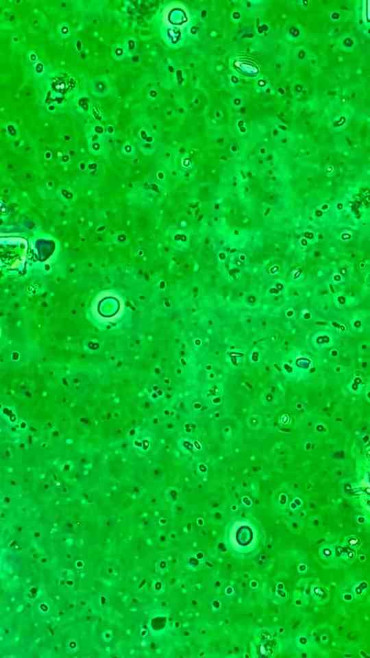 Yuck! - Bro finds living organisms on toothbrush under the microscope!