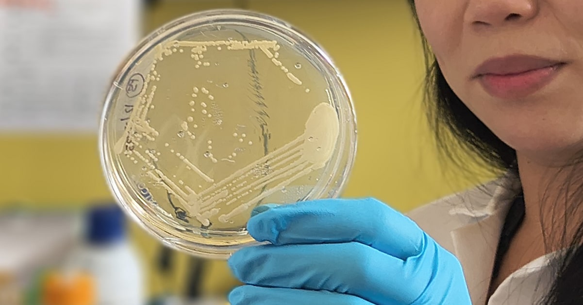 Gut bacteria behind rare 'auto-brewery syndrome' that causes ...