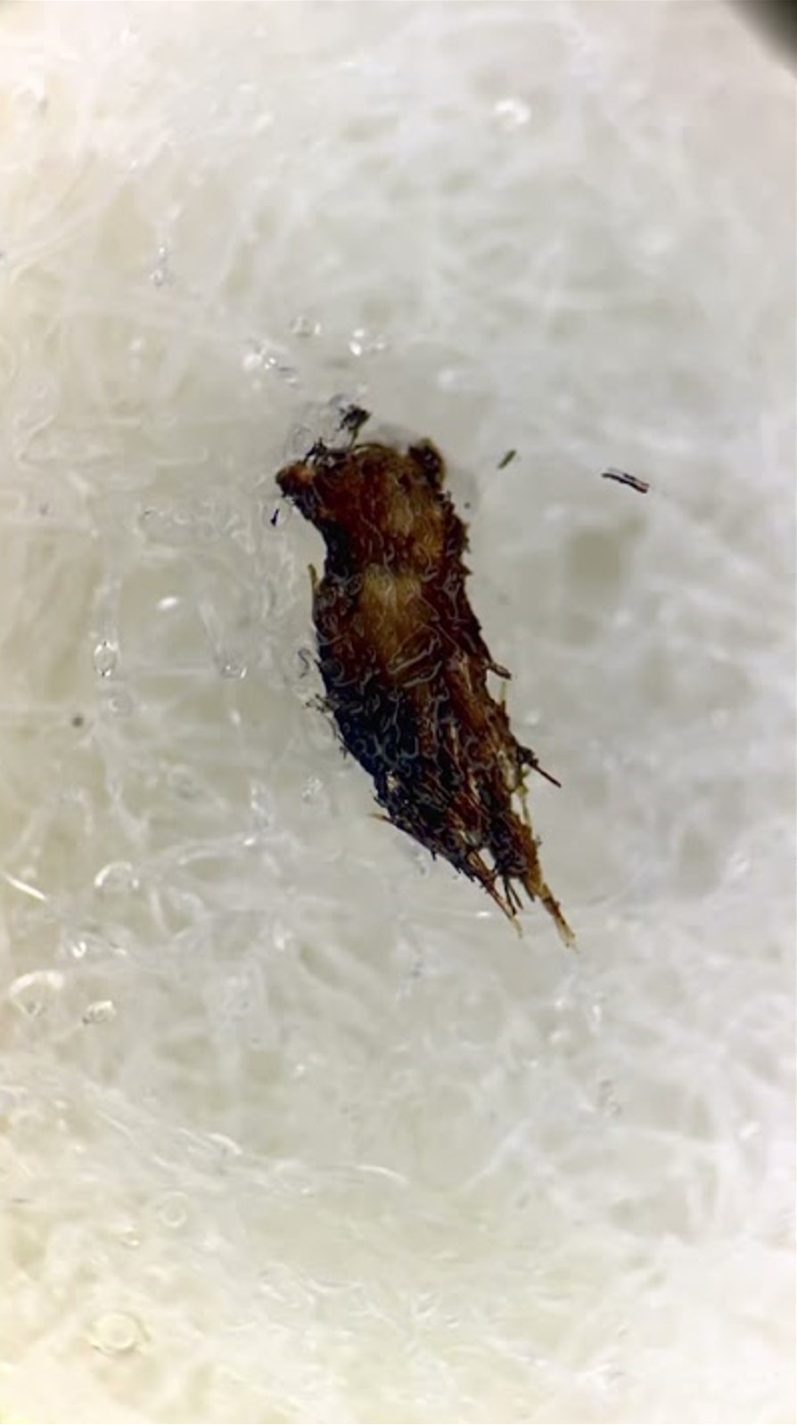 Bro looks at a used vape under the microscope - you won’t believe what ...