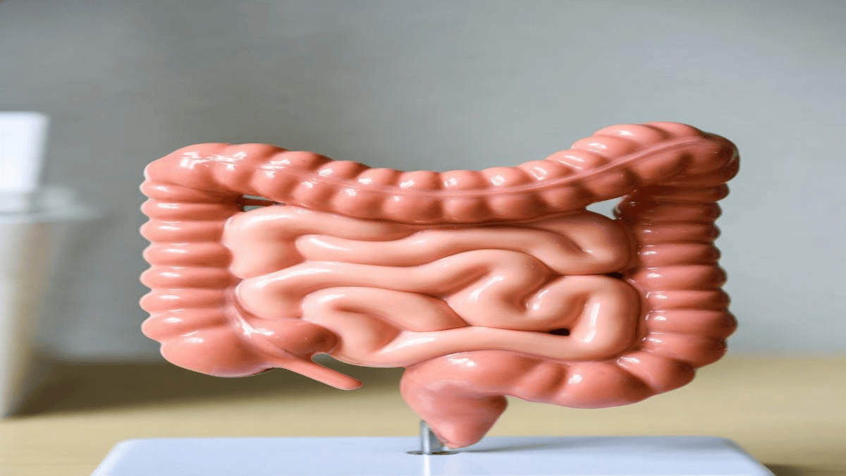 Scientists identify gut bacteria behind auto-brewery syndrome, a rare ...