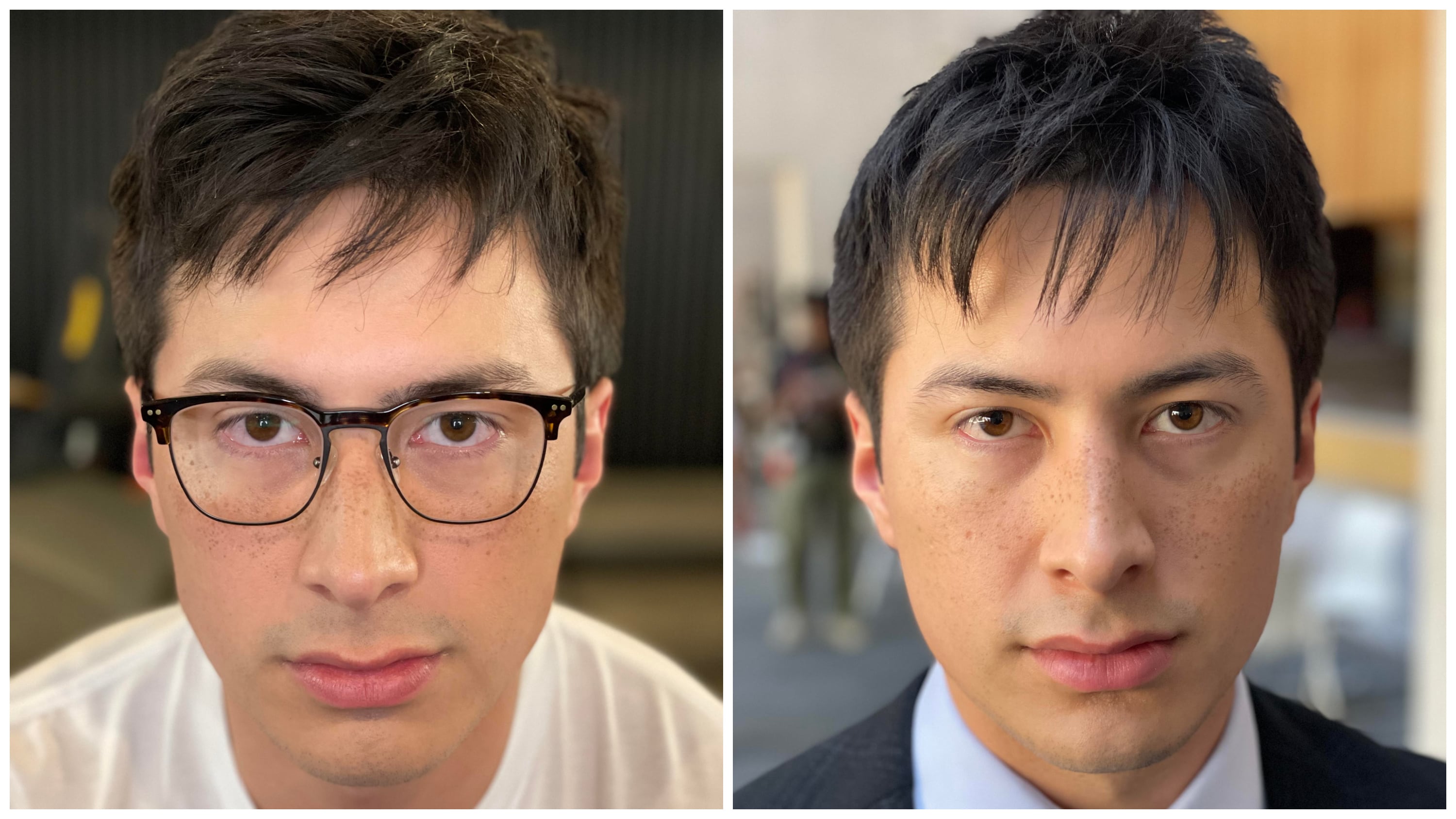 The $9 Amazon product behind TV’s most talked-about freckles