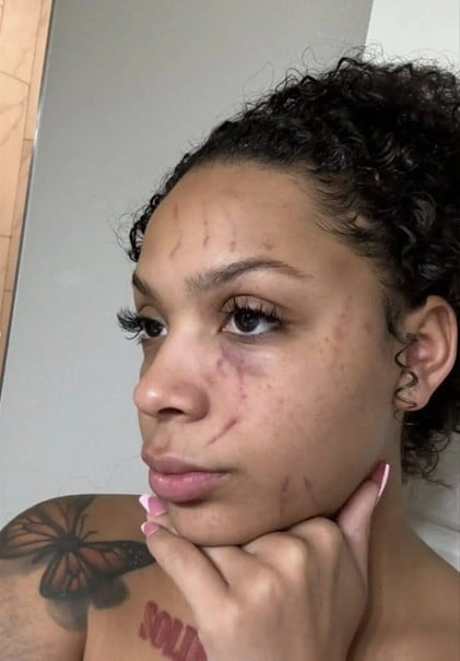 Rashee Rice’s ex-girlfriend alleges years of domestic abuse in social ...