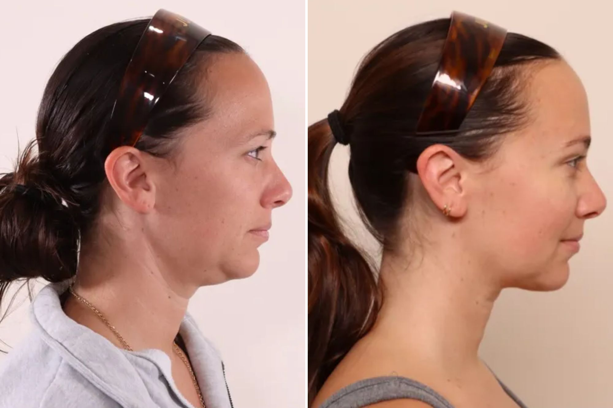 'Shrink wrapping' is the hot new skin-tightening and fat-melting ...