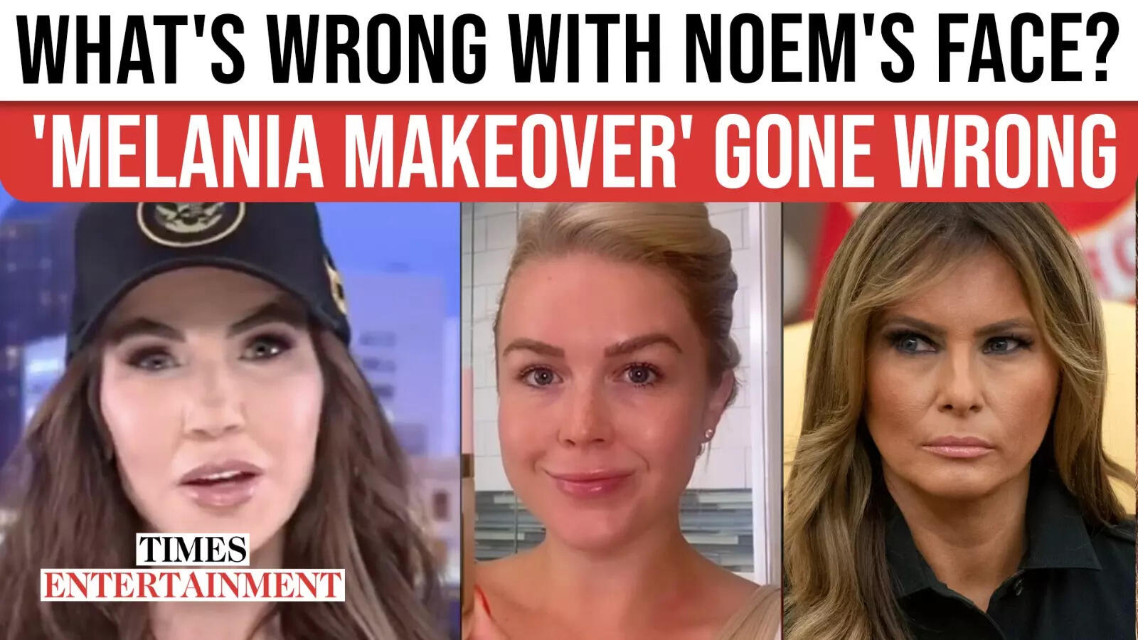 Kristi Noem's 'new face' breaks the internet, plastic surgeon reacts to ...