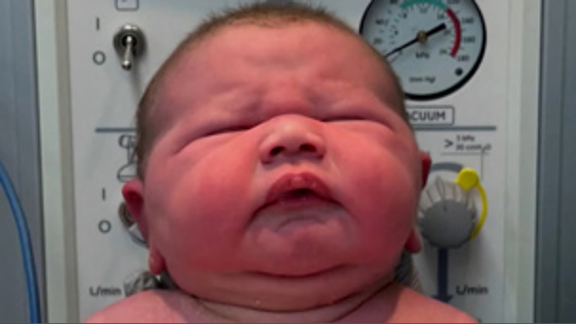North Texas mom gives birth to 'huge' baby weighing nearly 13 lbs