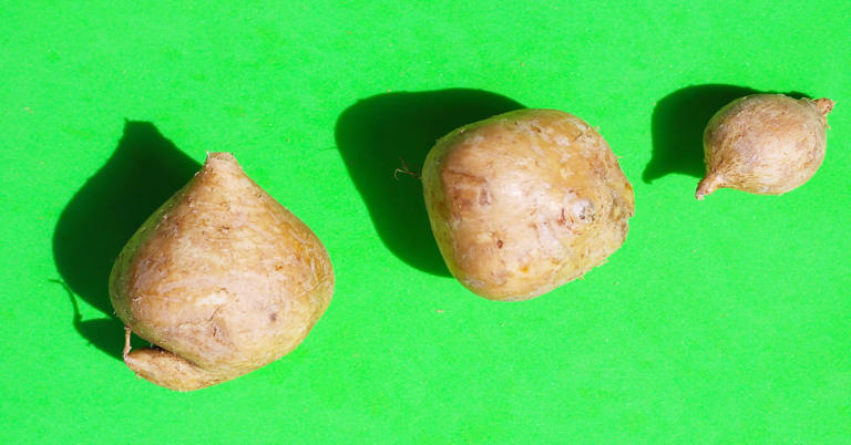 I'm a heart surgeon: Most people don't eat enough of these 5 ...