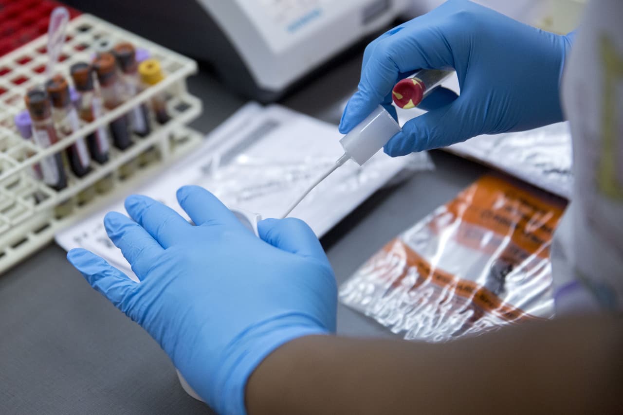 Clinical labs hope to head off looming Medicare cuts