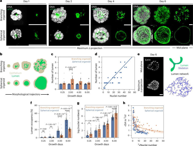 Scientists map development of pancreas transport channels that deliver ...