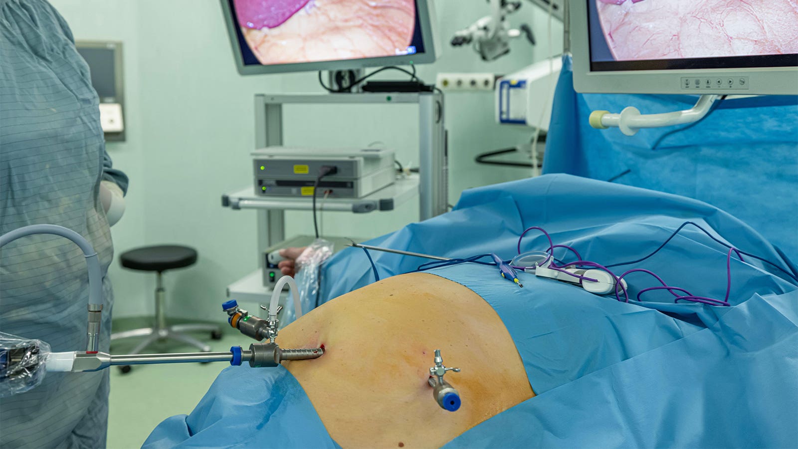 Surgery beats GLP-1 drugs for fat loss, muscle retention, study suggests