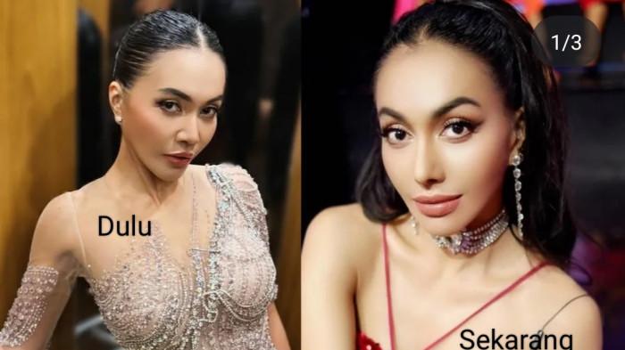 Sosok Ressa Rizky Rossano, mendadak mengaku anak pedangdut Denada ...