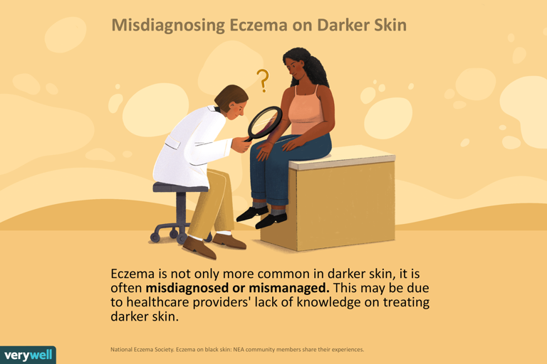 Eczema on dark skin: Common triggers, symptoms, and treatment