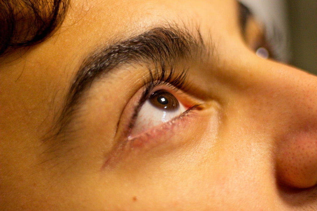 What are “bottom eyes” & where did they come from?