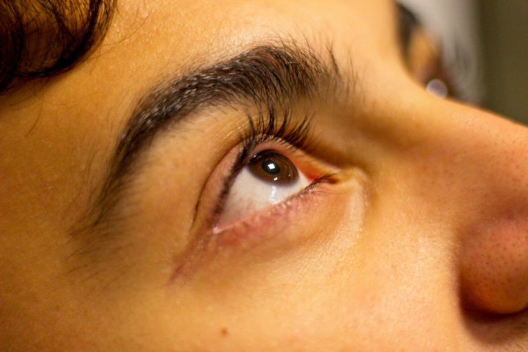 What are “bottom eyes” & where did they come from?