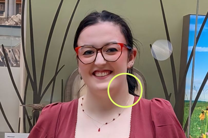 I found a lump in my neck - an X-ray showed me what it really was