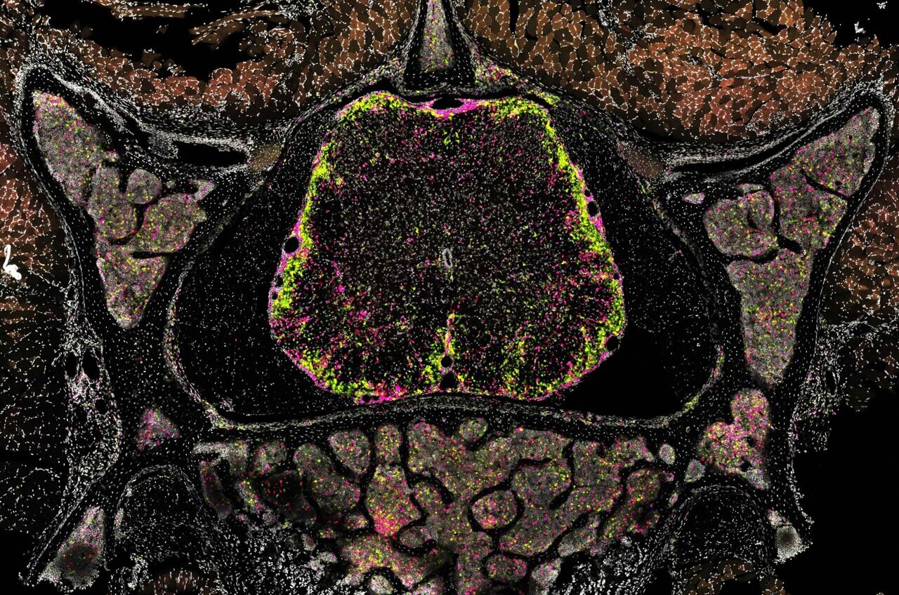 New insight into the immune signals driving inflammation in multiple ...