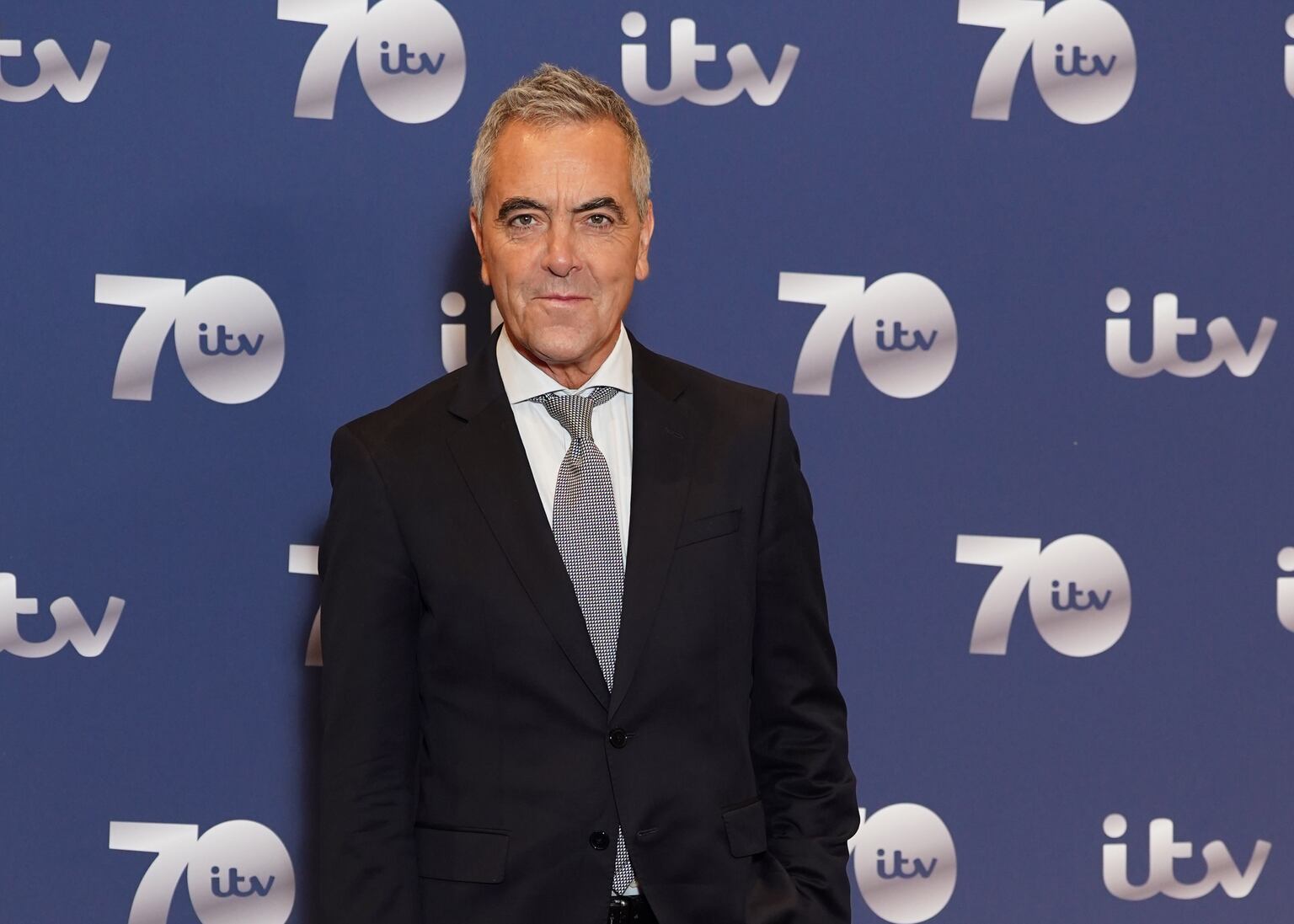 Run Away actor James Nesbitt struggled with Northern Ireland being seen ...