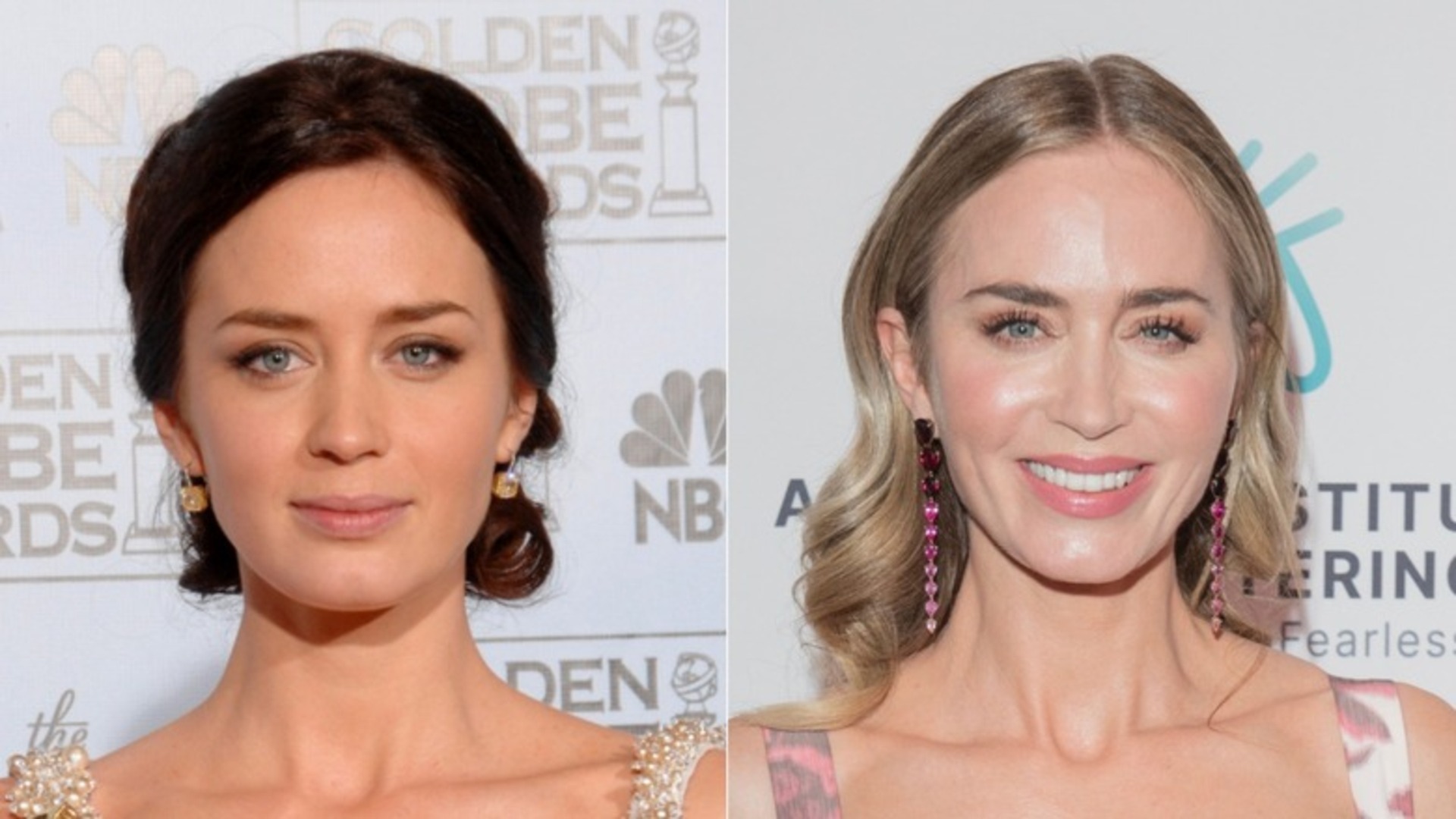 How Emily Blunt's face has transformed, according to our plastic surgeon