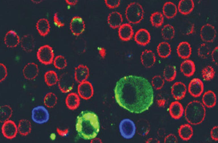 TAU discovers breakthough mechanism for treating deadliest type of skin ...