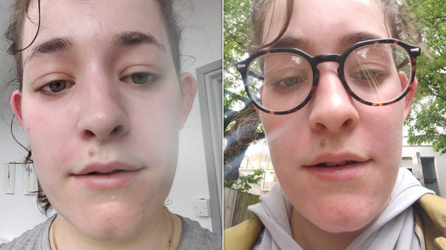 Here's what it means if your face gets bright red after a workout