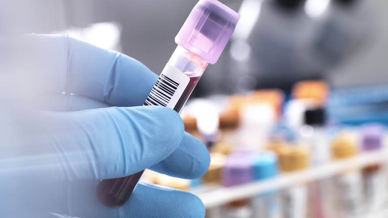 New blood test could finally diagnose chronic fatigue and long COVID