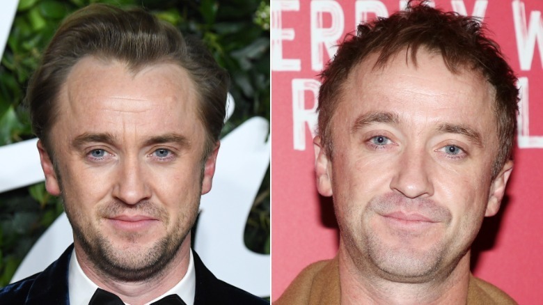 Side-by-side pics of Tom Felton's face transformation are jarring