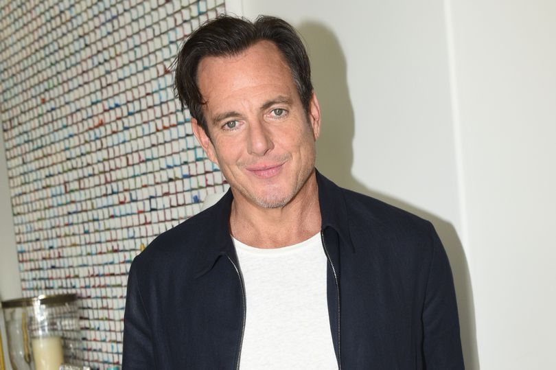 Will Arnett thinks he'll lose Golden Globe to ex-wife Amy Poehler in ...