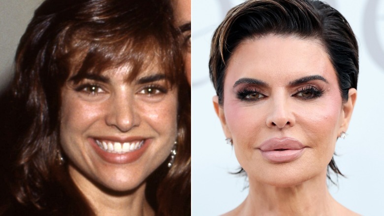 Lisa Rinna's plastic surgery is so obvious in side-by-side pics