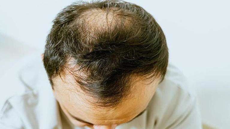 Güney Kore lideri kelliğe savaş açtı! 'Ölüm-kalım meselesi' mi yoksa ...