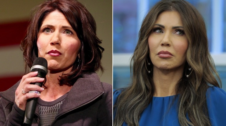 Kristi Noem's face has drastically changed through the years