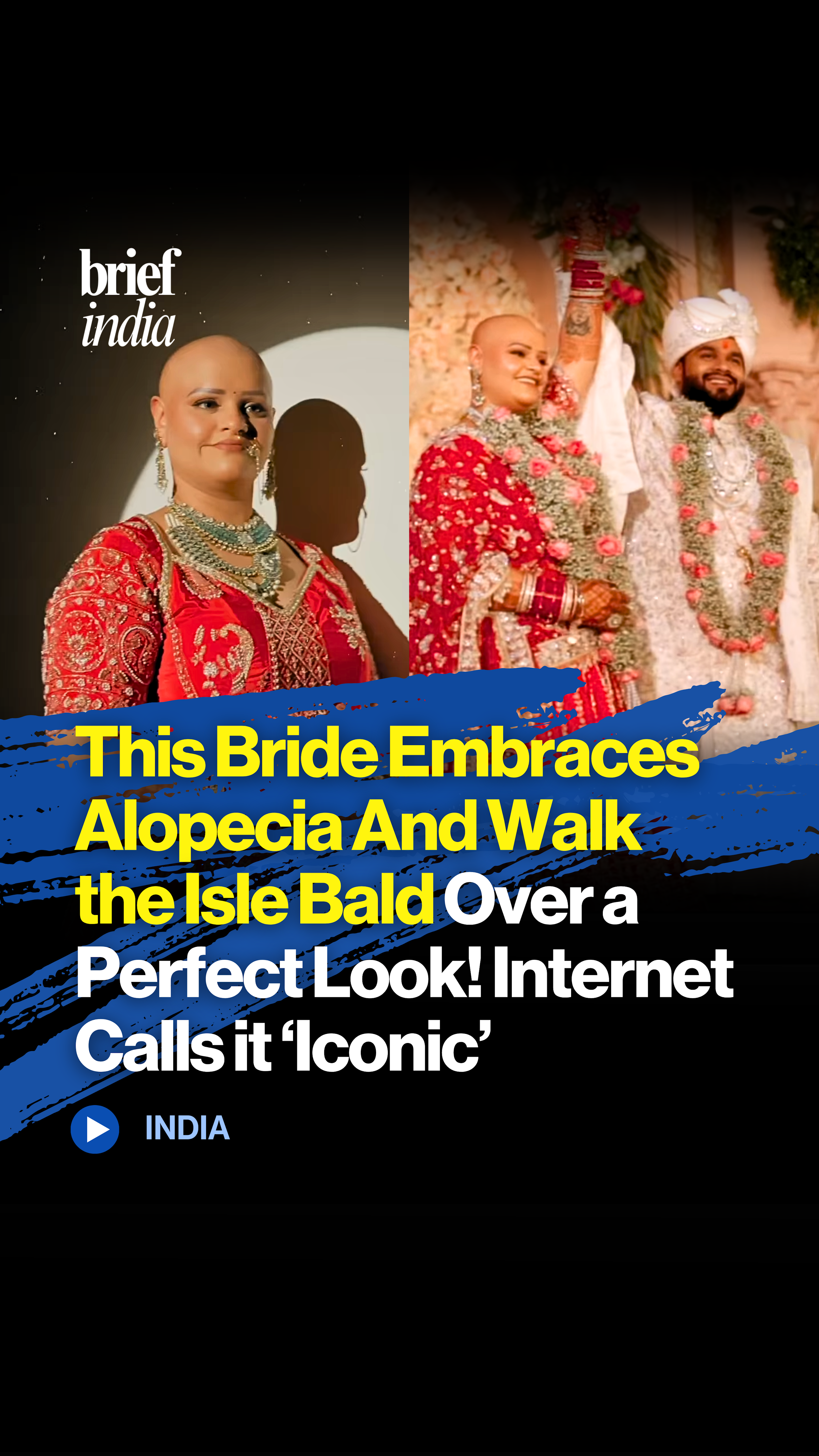 I look beautiful without hair: Mahima Ghai walks the aisle bald, wins ...