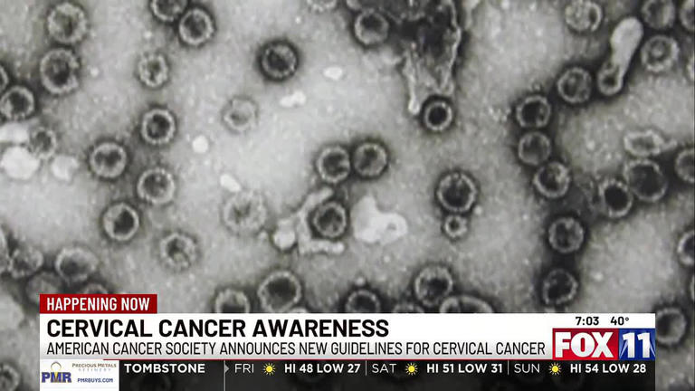 Making cervical cancer screening more widely available
