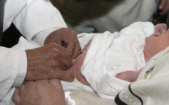Circumcision could be child abuse if done wrong, draft UK guidelines ...