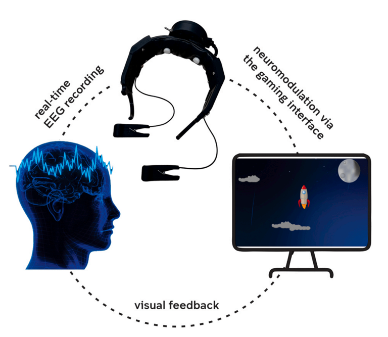 Brain training game shows early promise for treating chronic pain ...