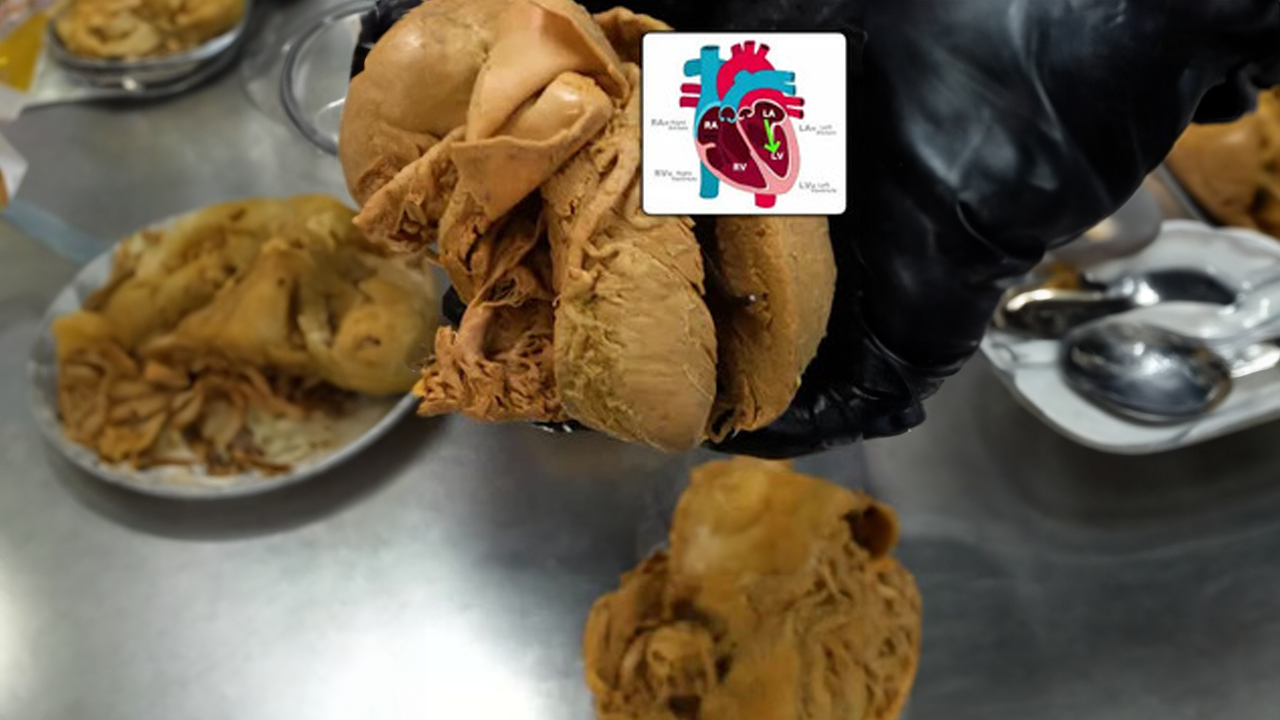 Right vs. Left Heart Ventricles