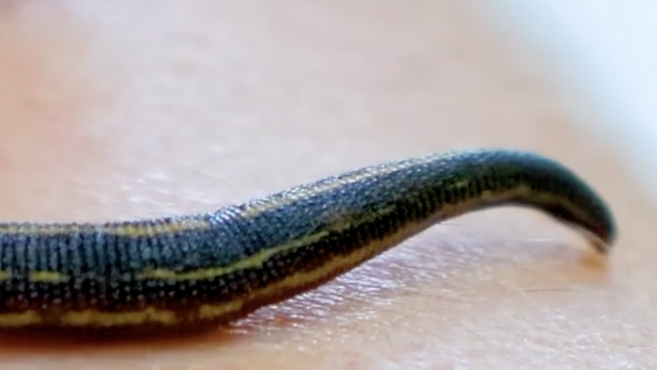 Close call with a blood-sucking parasite