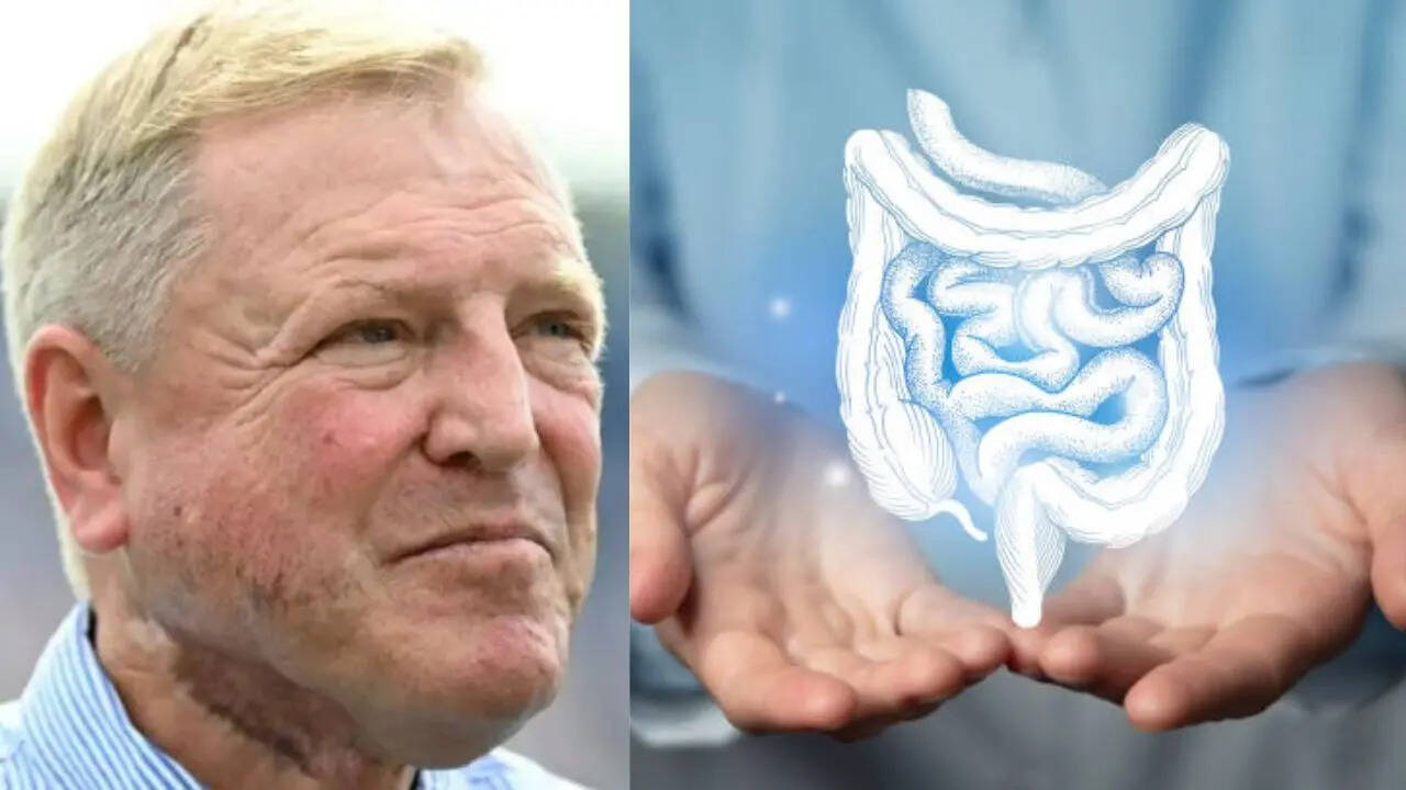 Hugh Morris death: What is bowel cancer, the disease the former England ...