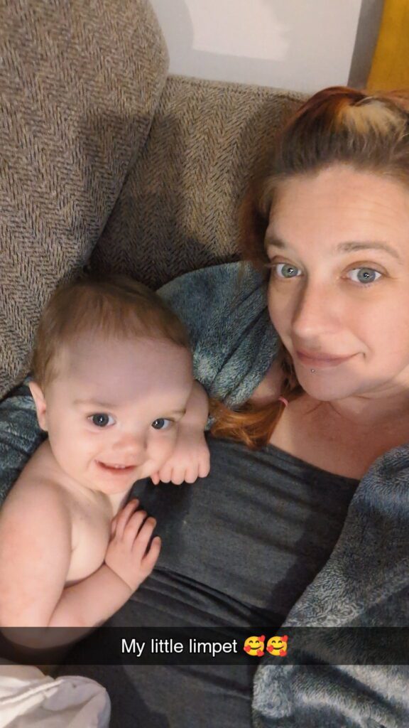 Baby’s wide eyes sign of syndrome so rare it doesn’t have a name