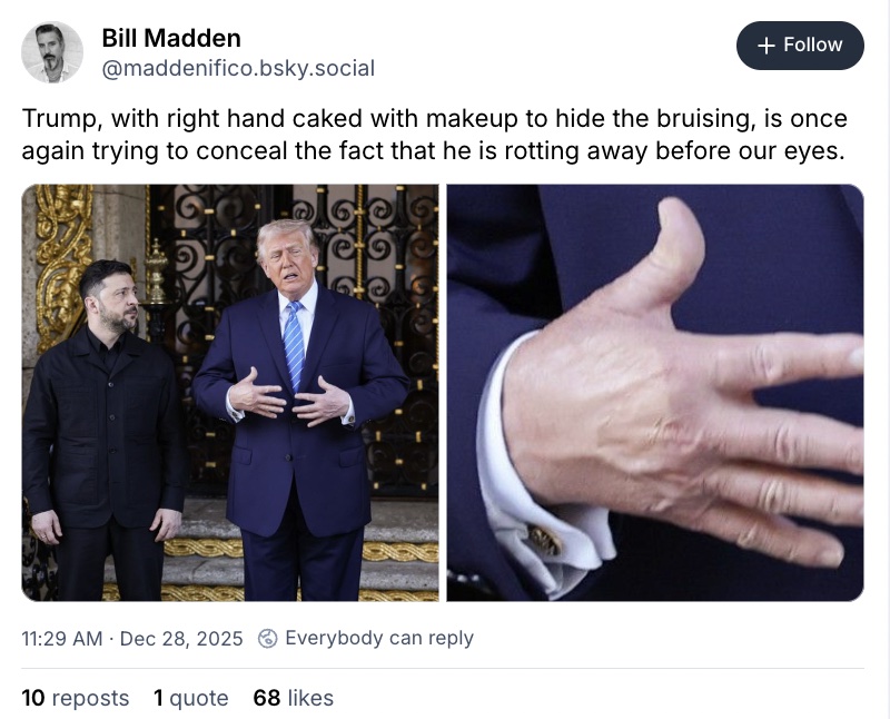 Trump’s ‘painted’ hands spark social media speculation after Mar-a-Lago ...